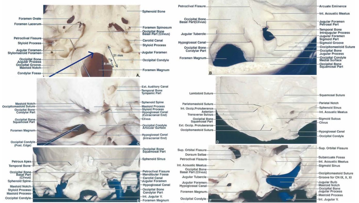 Far-Lateral Approach and Extensions | Cohen Collection | Volumes | The ...